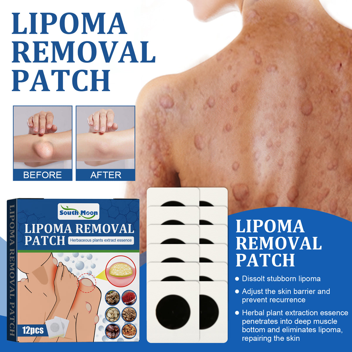 Lipoma Removal Patch, Soothing Various Body Fat Knots To Remove Subcut ...