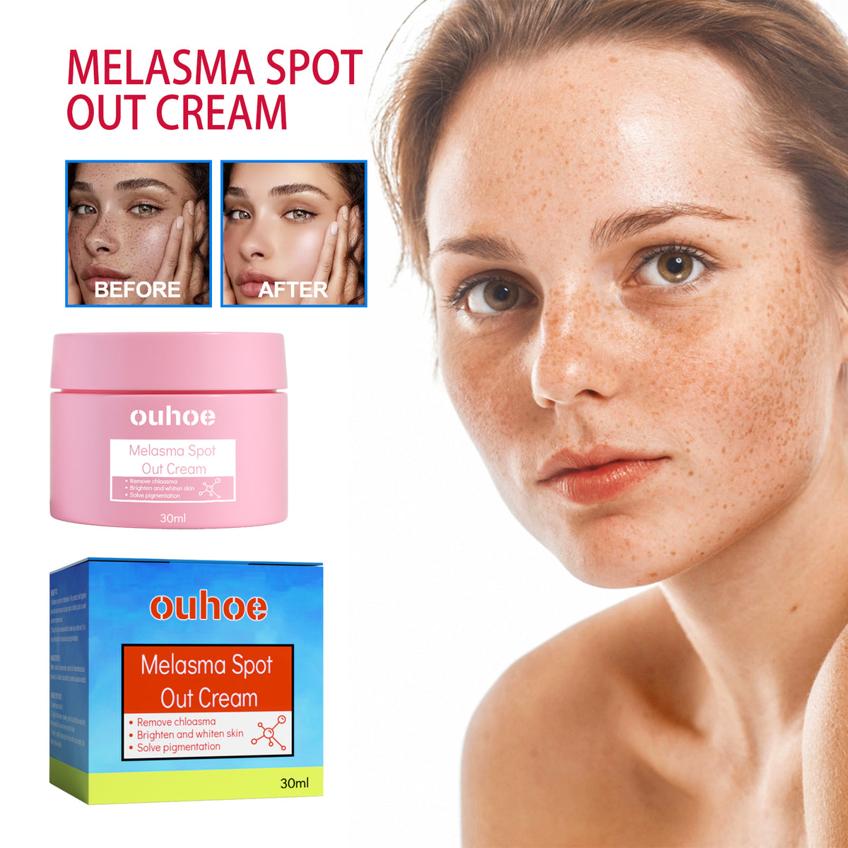 Blemish Cream, Whitening Skin Reduce Melanin Melasma Stains And Hydrat ...
