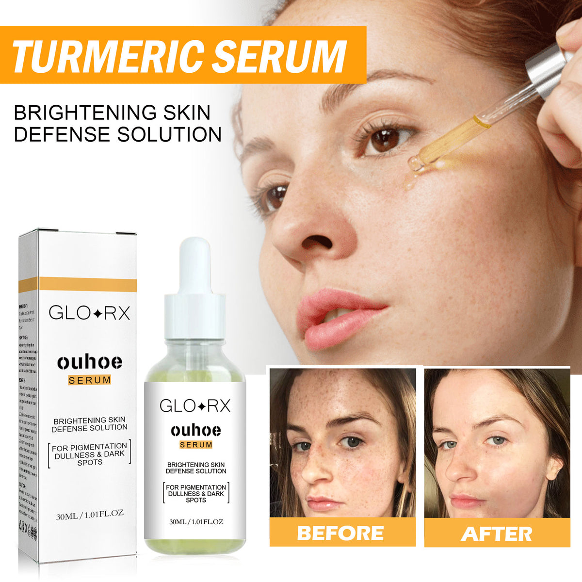 Turmeric Whitening Spot Serum, Lighten Freckle Spots Brightening Skin ...